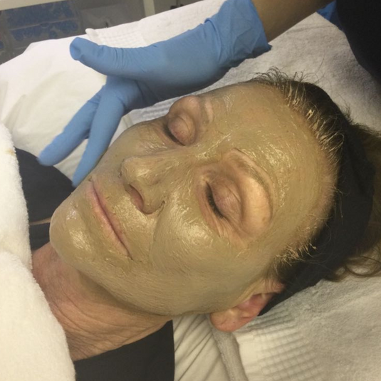 Cosmelan Depigmentation Peel Treatment, Central London – Medicetics