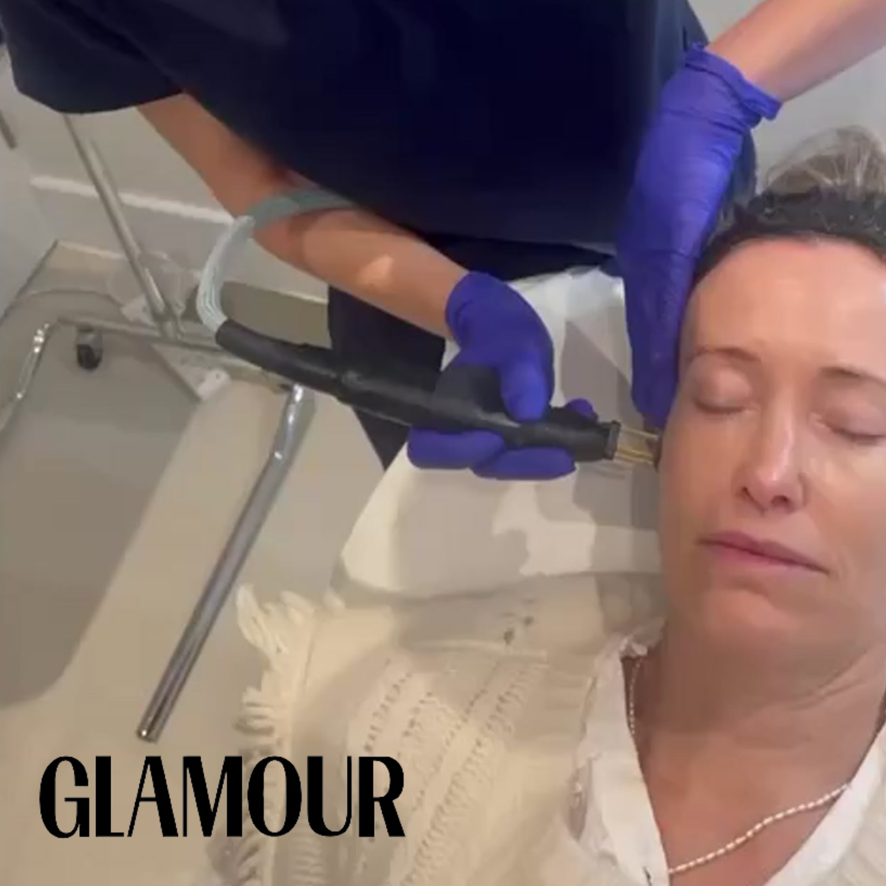 NeoGen Plasma, Skin Regeneration Treatment – Medicetics